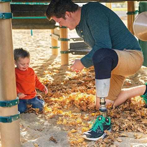 Below Knee Prosthetics