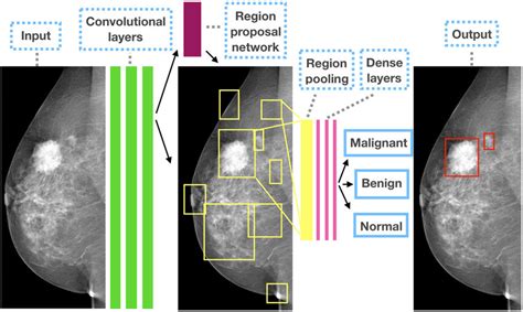 The Outline Of The Faster R Cnn Model For Cad In Mammography