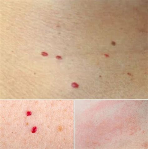 Causes And Potential Meanings Of Red Spots On Your Skin