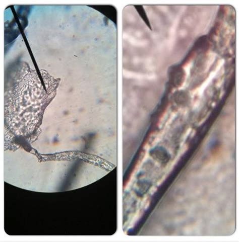 Asbestos Fibers Under Microscope