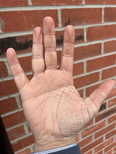 33m Red Palms Rmedical