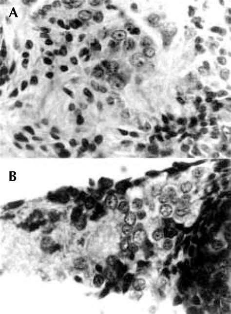 Neural Tissue Differentiated After 14 Days In Serum Free Media In Download Scientific Diagram