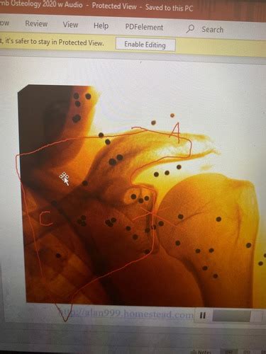 Lab 6 Practical 2 Appendicular Skeleton Flashcards Quizlet