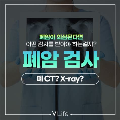 대구 폐암 Ct 엑스레이 중 어떤 검사를 받아야 할까 네이버 블로그