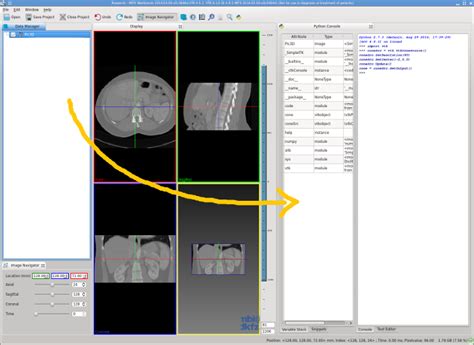 Medical Imaging Interaction Toolkit The Python Plugin