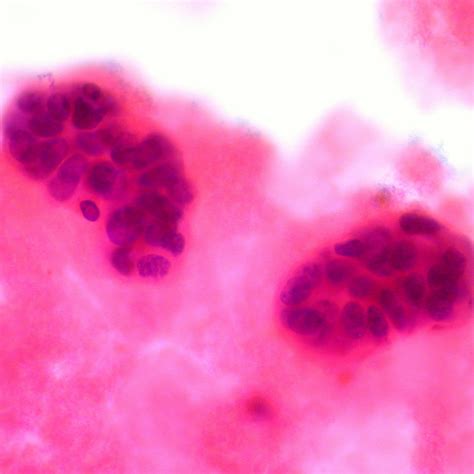 Multimodality Breast Imaging And BiopsyUpdates For Your Practice ARRS InPractice