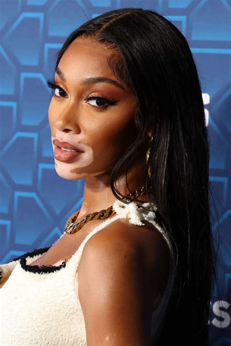 What Is Vitiligo A Dermatologist Explains The Skin Condition