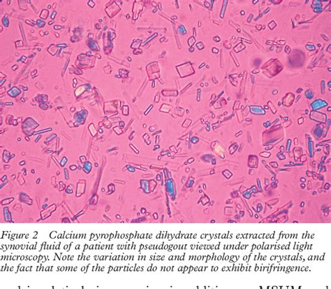 Cppd Crystals