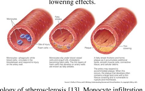 Figure 2 From Production Of Lovastatin And Its Lipid Lowering And Anti