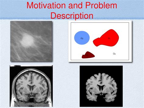 Ppt Mri Brain Extraction Using A Graph Cut Based Active Contour Model Powerpoint Presentation