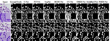 Github Kabbas570pmed Net Pyramid Based Multi Scale Encoder Decoder Network For Medical Image