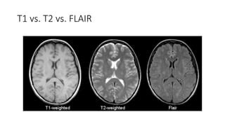 Mri Brain Sequences PPTX