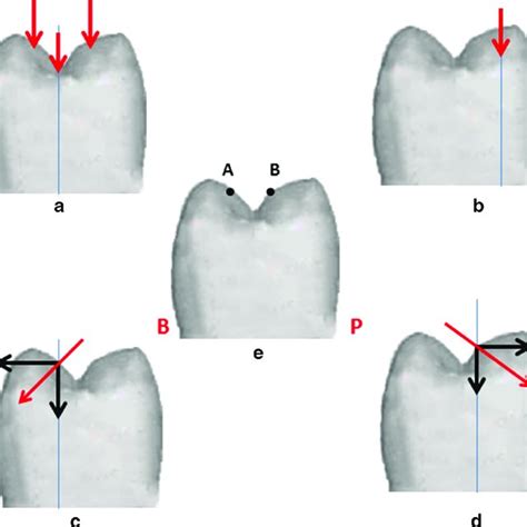 A Loading I B Loading II C Loading III D Loading IV And E Points A Download Scientific
