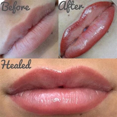 Stages Of Lip Procedure Seamless Airbrushed Part Lip Blend