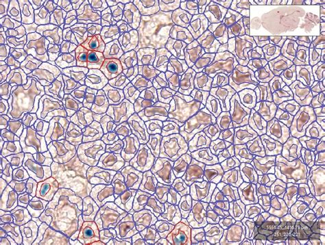 Positive Cell Detection Too Many False Positives Image Analysis