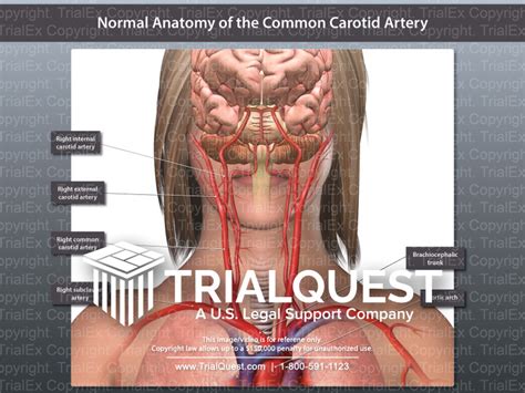 Left Common Carotid Artery