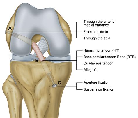 Anatomy Of The Acl