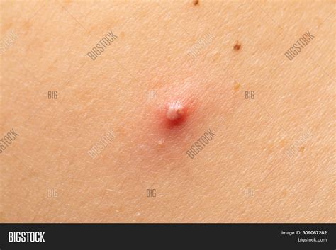 Close Picture Red Image Photo Free Trial Bigstock