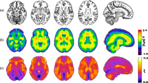 A Representative Axial Images And Sagittal View Last Column From Download Scientific
