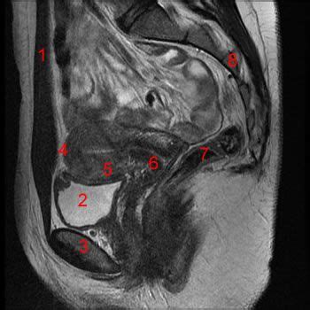 Female Pelvis Anatomy Mri
