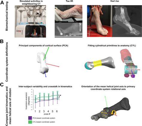 Standardizing 3 Dimensional Measurements In Foot And Ankle Imaging Foot And Ankle Clinics