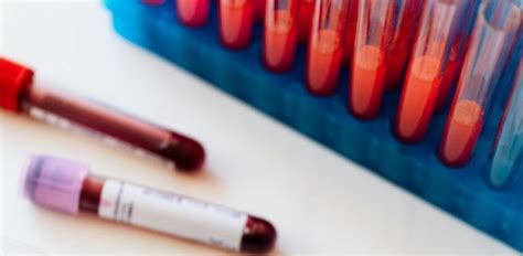 Eritrocite Scazute Ce Inseamna Si Care Sunt Cauzele Cancer