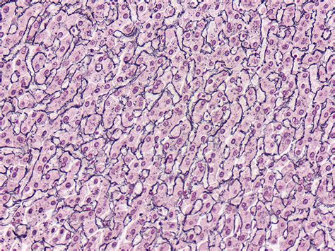 Reticulum Histology Slides