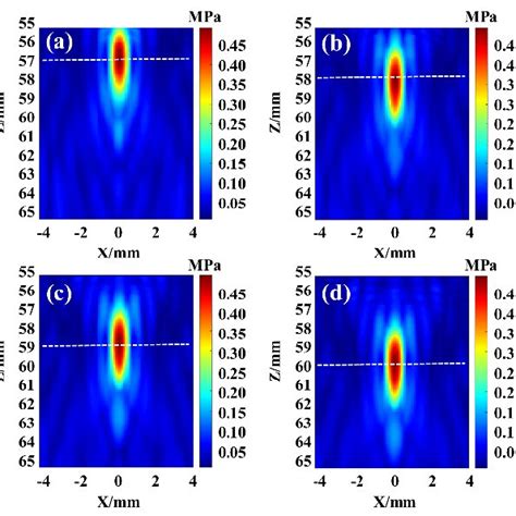 Schematic Of Array Calibration Transcranial Geometric Focusing And