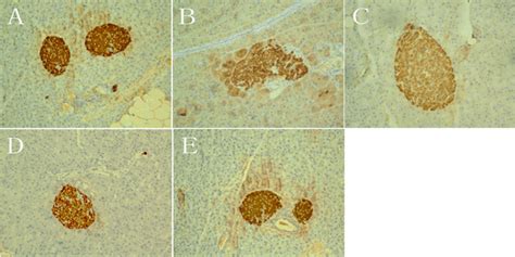 effects of oxa on islet morphology and insulin expression db mice