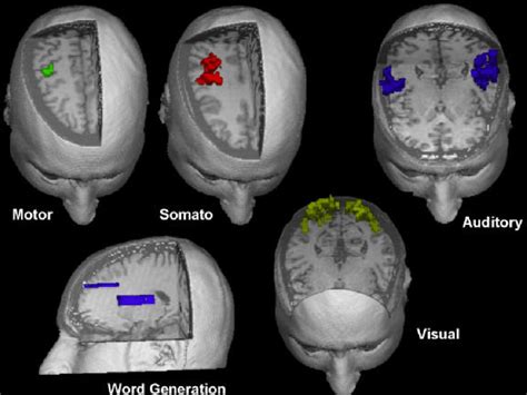 Human Brain Mapping Fmri Mapping Of Different Functional Systems In A