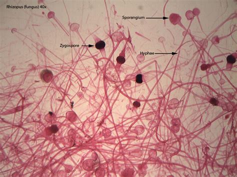 Image Result For Rhizopus Zygotes Under Microscope Labeled
