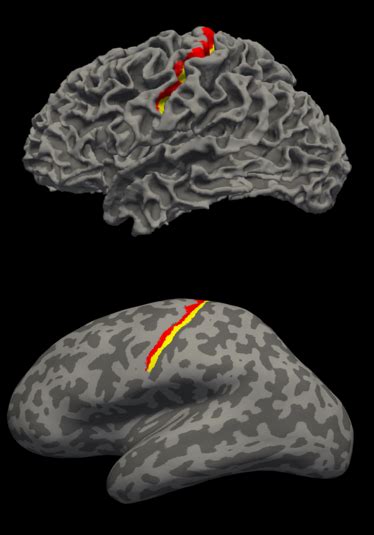 T1 Weighted Image Based Automated Parcellation Of The Primary Motor