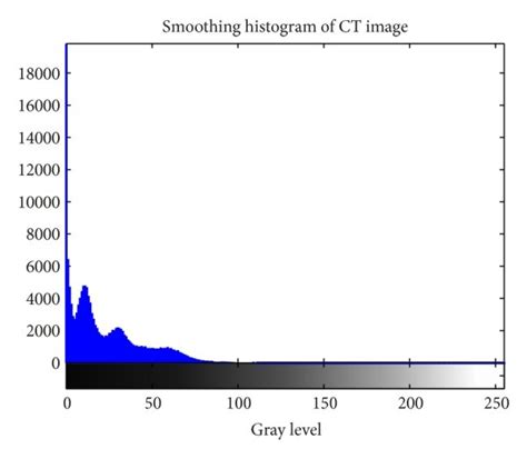 Histogram And Smoothing Histogram Of Ct Slice Download Scientific Diagram