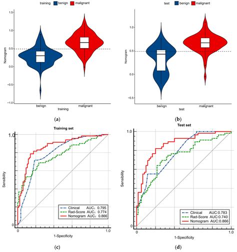Ultrasound Radiomics Nomogram To Diagnose Sub Centimeter Thyroid Nodules Based On Acr Ti Rads