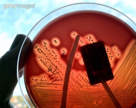 Streptococcus Pyogenes Group A Streptococci 이미지 1315881073 게티이미지뱅크
