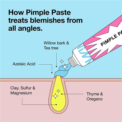 Innbeauty Project Pimple Paste Overnight Blemish Drying Paste Mall Of America®