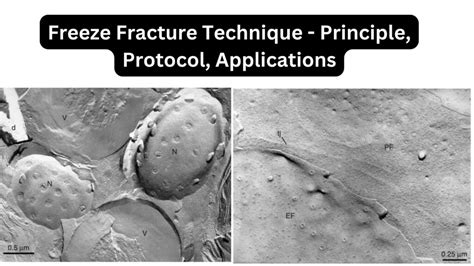 Freeze Fracture Technique Principle Protocol Applications Biology