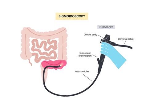 Premium Vector Colonoscopy And Sigmoidoscopy Test Examination And