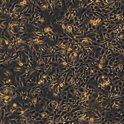 人结缔组织纤维肉瘤细胞ht 1080 Icas9 现货价格 详情介绍 960化工网 960化工网