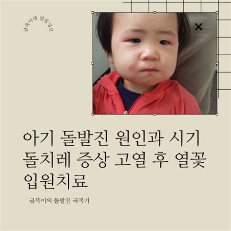 아기 돌발진 원인과 시기 돌치레 증상 고열 후 열꽃 입원치료 네이버 블로그