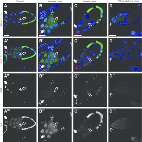 The Ecdysis Cascade Begins With The Ventro Medial Cells Vm Cells Download Scientific Diagram