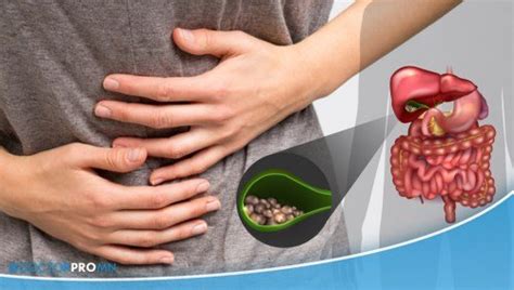 Цөсний чулууг 7 хоногийн дотор гадагшлуулах хятадын нууц арга Ospring Technology And