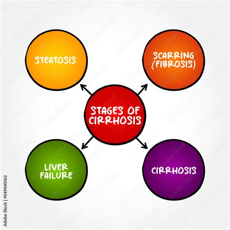 Stages Of Cirrhosis Scarring Of The Liver Caused By Long Term Liver