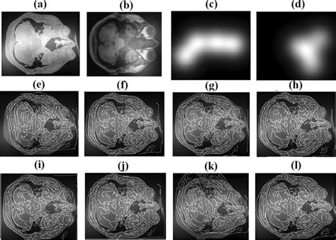 Registration Performance Of Various Methods In The Presence Of Additive