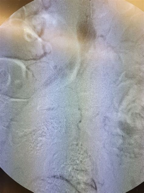 Daniel M Alterman Md Facs Fsvs Rpvi On Linkedin Inflow