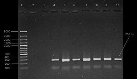 scpb gene specific pcr for s agalactiae 255 bp lane 1 100 bp
