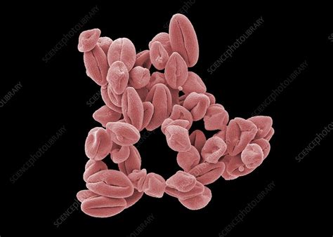 Hypericum Pollen Stock Image C0049481 Science Photo Library