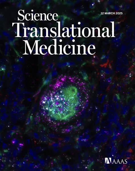Sex Differences And Immune Correlates Of Long Covid Development