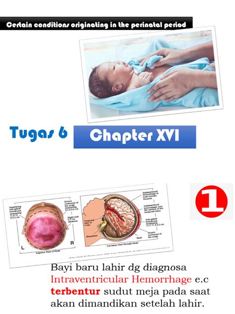 7tugas7chapterxvicodingperinatal Pdf