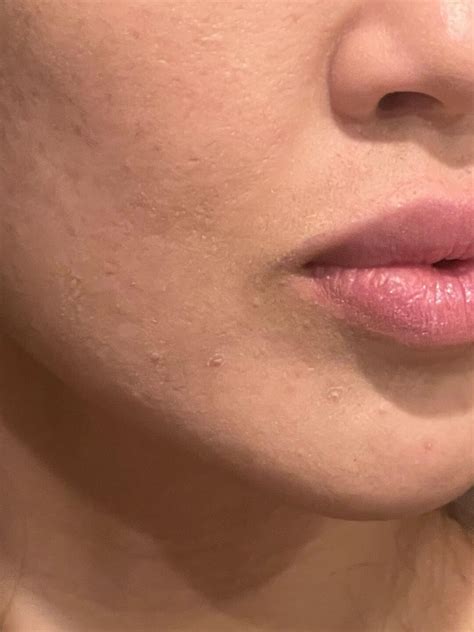 Benefit Porefessional Matte Primer Review With Photos Ipsy